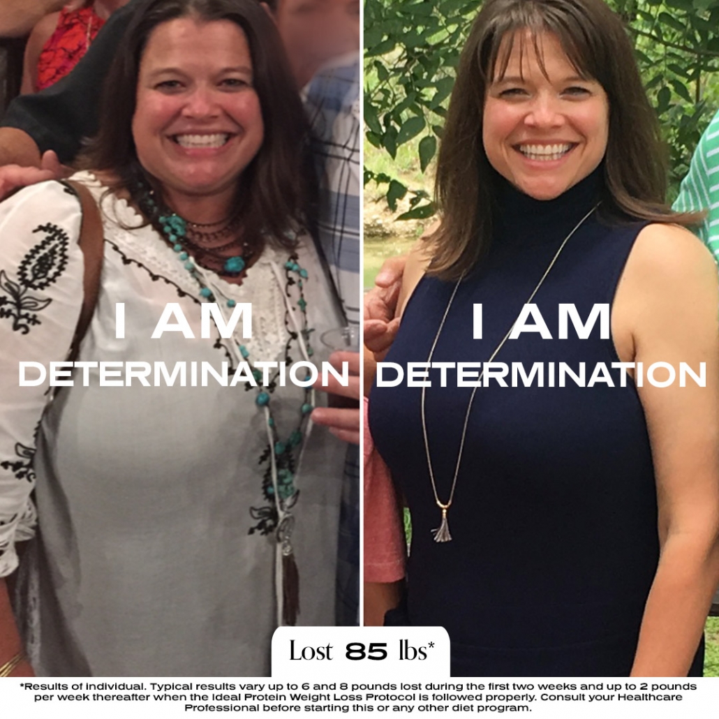 Naperville Weight Loss | Ideal Weight Loss Program Naperville ...