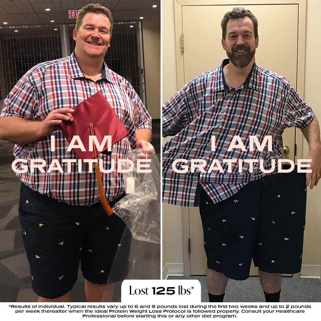 Naperville Weight Loss | Ideal Weight Loss Program Naperville ...