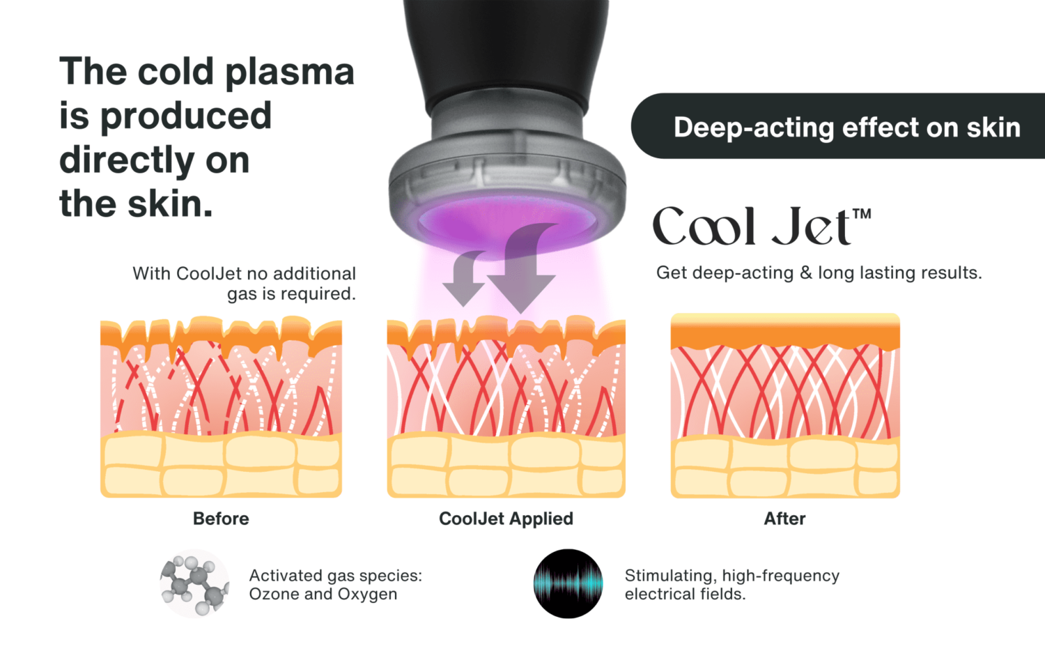 Cool Jet Plasma Naperville | Cool Jet Plasma Facial Near Me ...